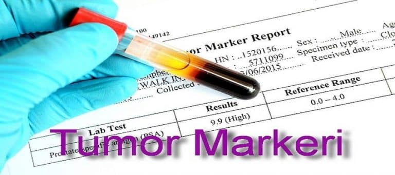 Tumorski markeri - Poliklinika ANALIZA
